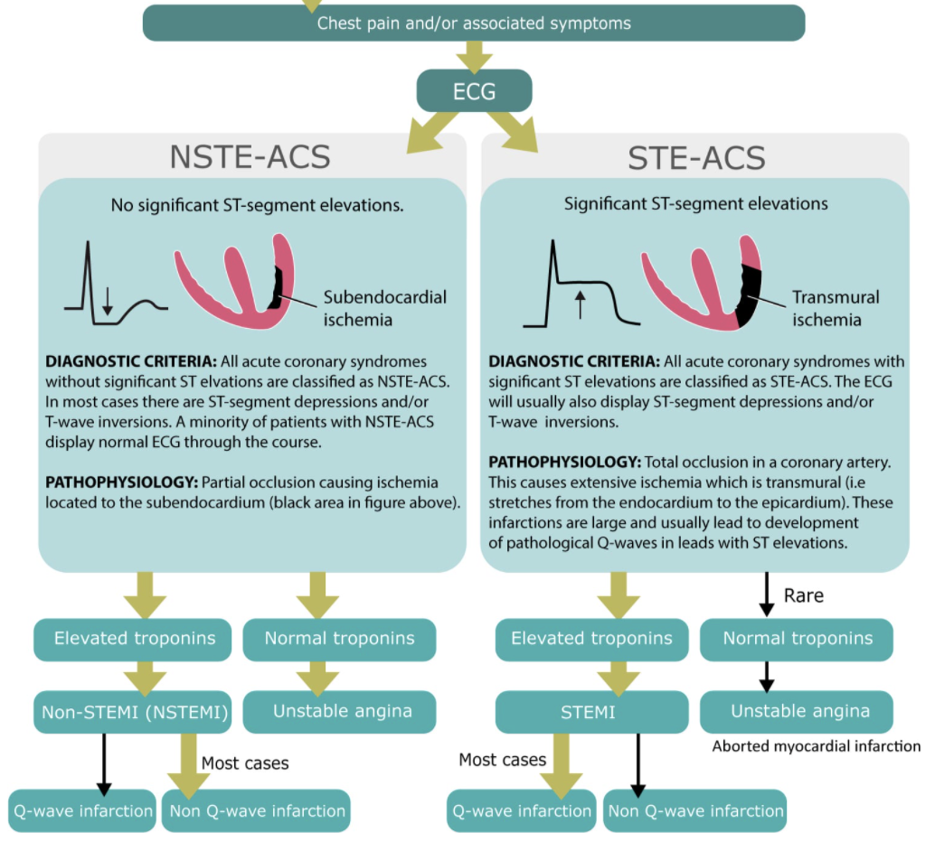 ACS Part ️: Presentation and Diagnosis – CARDS RX (explained)