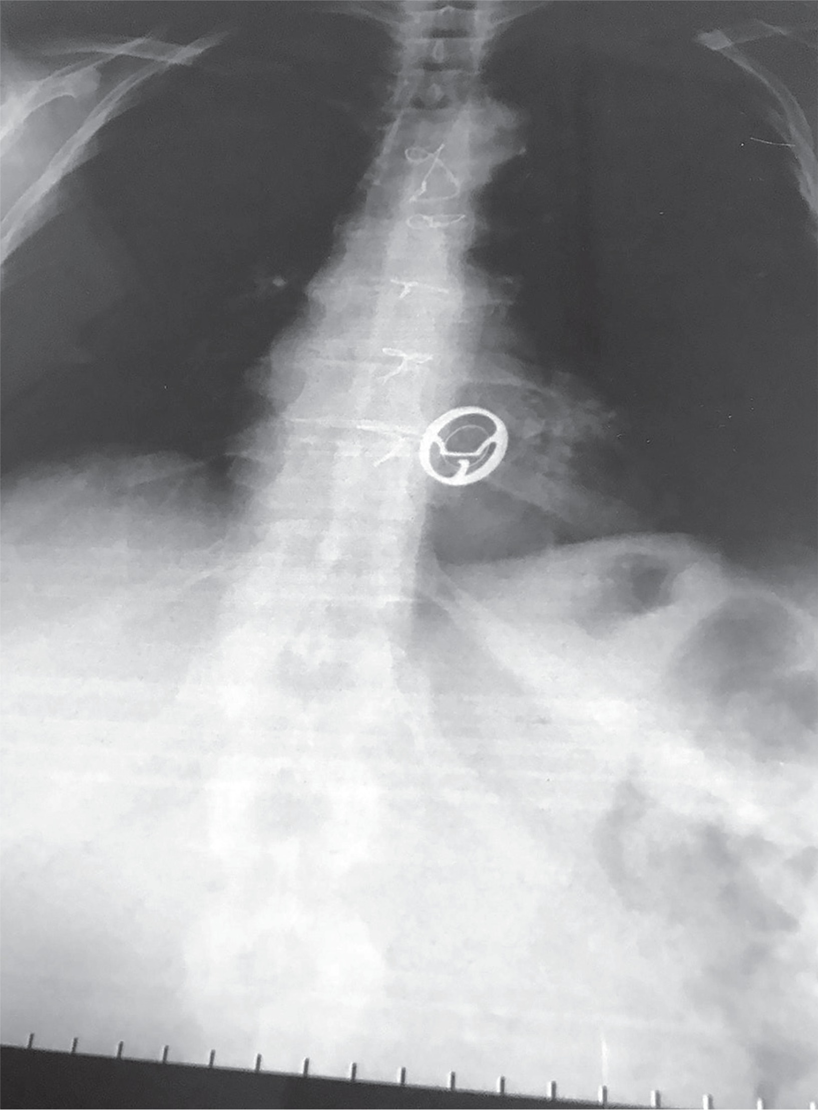 Valvular Disease Part 2: Treating Valvular Dx Prior to Surgery and ...